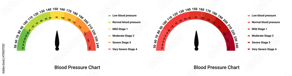 Blood pressure scale chart. Stage test with arrow and diagram ...