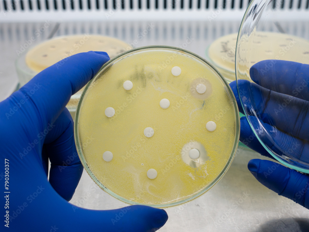 Round disks with antibiotics are placed in a Petri dish where ...