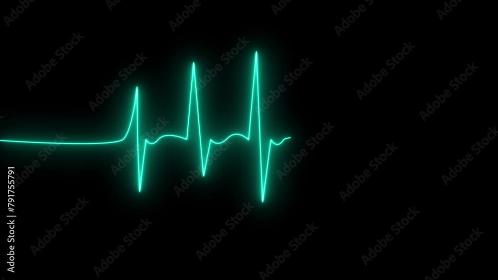 Heartbeat Monitor Animated Video, Heartbeat Medical Cardiogram ...