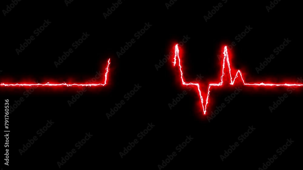 Heartbeat Monitor Animated Video, Heartbeat Medical Cardiogram ...