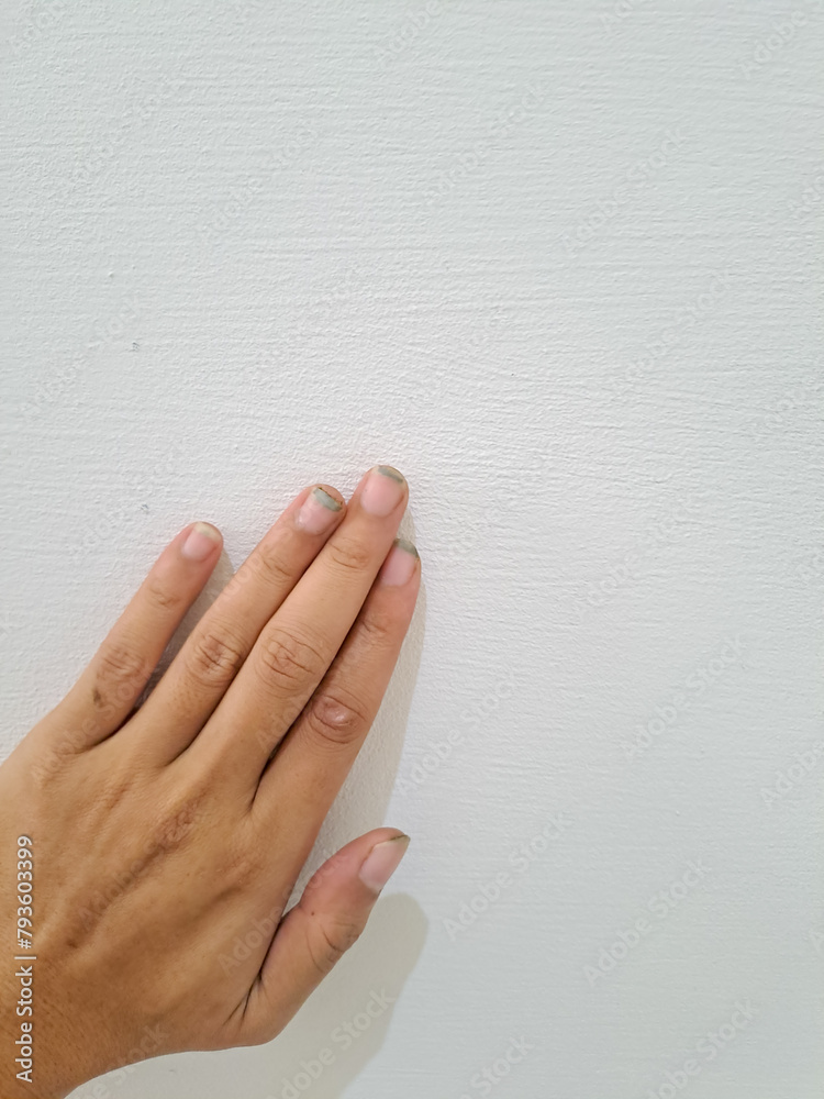 Dirty nails. a man's dirty fingernails on white background. damaged ...