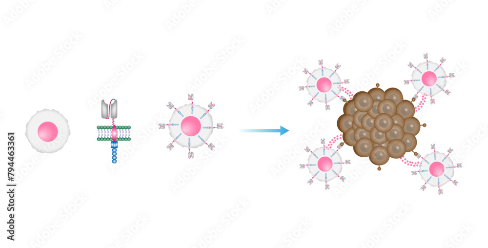 CAR T-cell therapy. Chimeric antigen receptor T cell ,CAR T cell, for ...