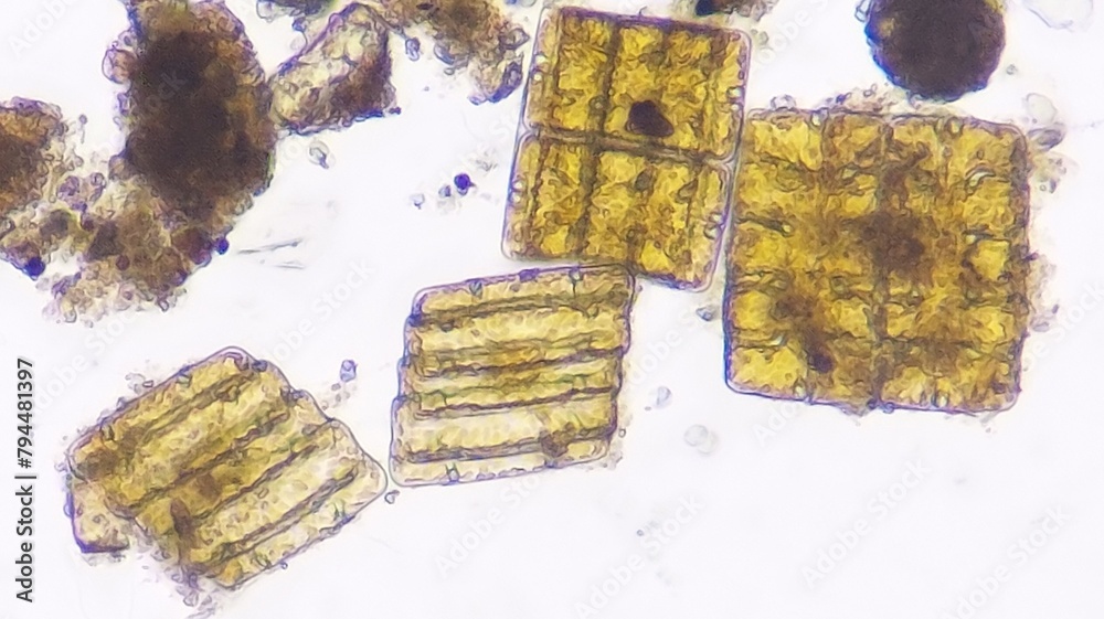 Terpsinoe sp, a microalgae belonging to diatom group. Colected from ...