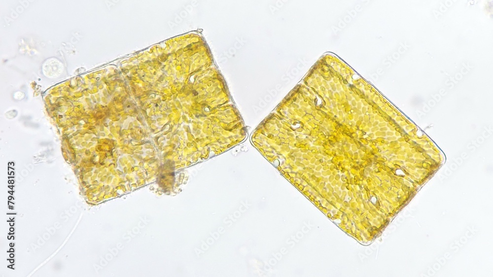 Terpsinoe sp, a microalgae belonging to diatom group. Colected from ...