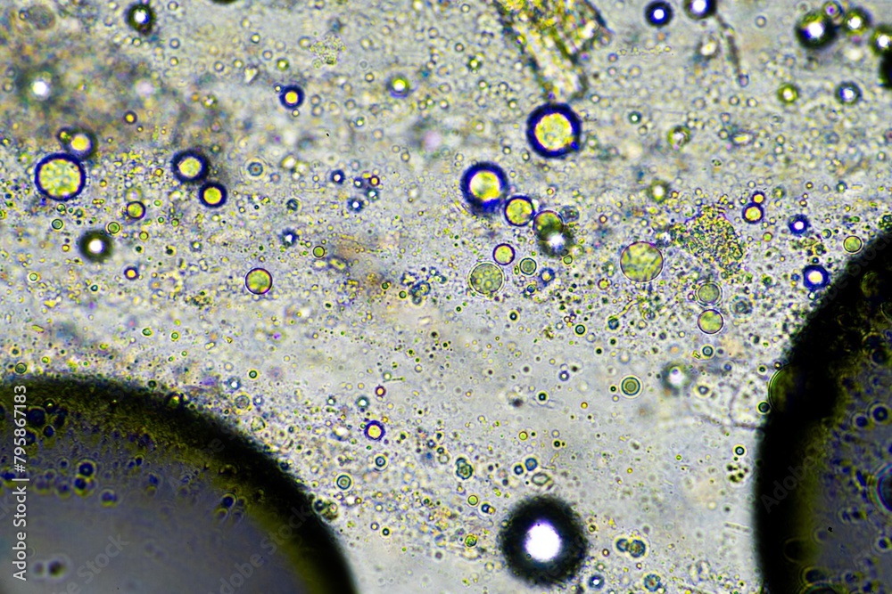 green mucus and coughing up phlegm under the microscope looking at ...