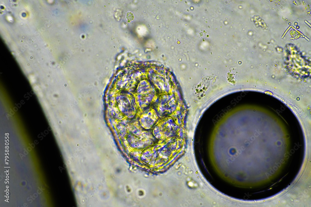 green mucus and coughing up phlegm under the microscope looking at ...