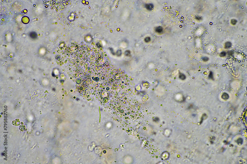 green mucus and coughing up phlegm under the microscope looking at ...