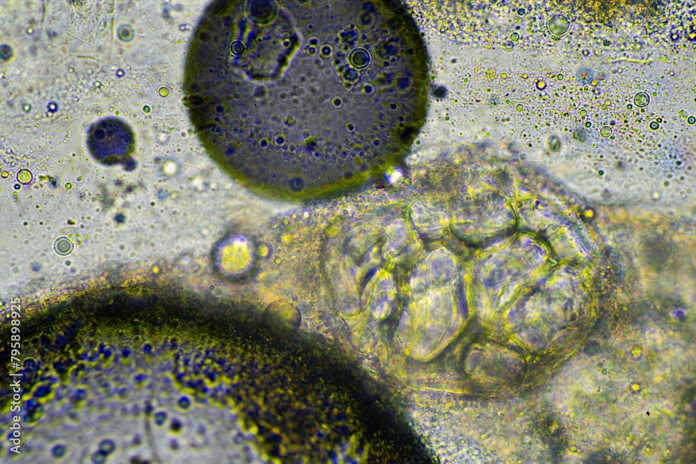 Fotografia do Stock: Coughing up mucus and phlegm from a chest ...