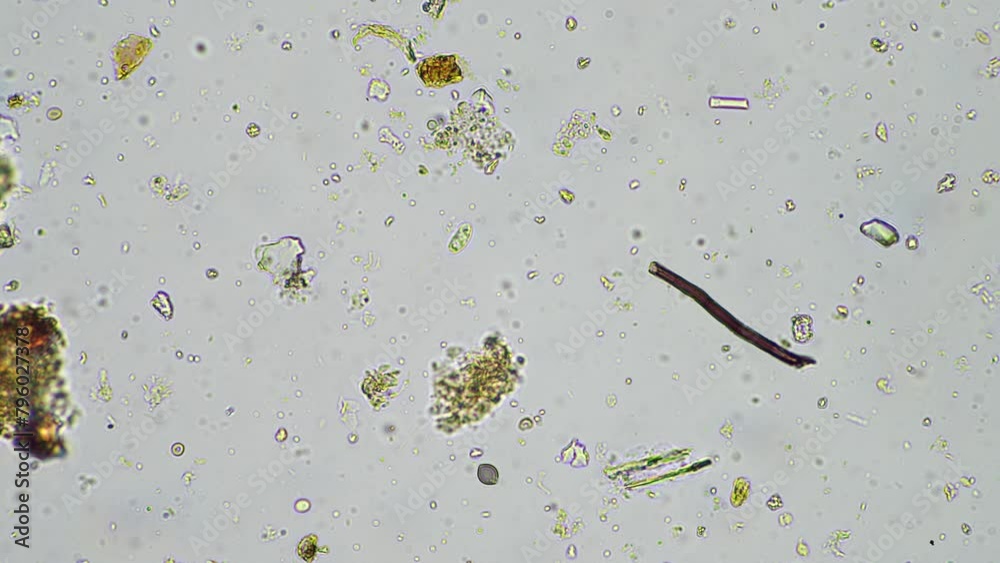 soil microorganisms in a soil life sample from a sustainable ...