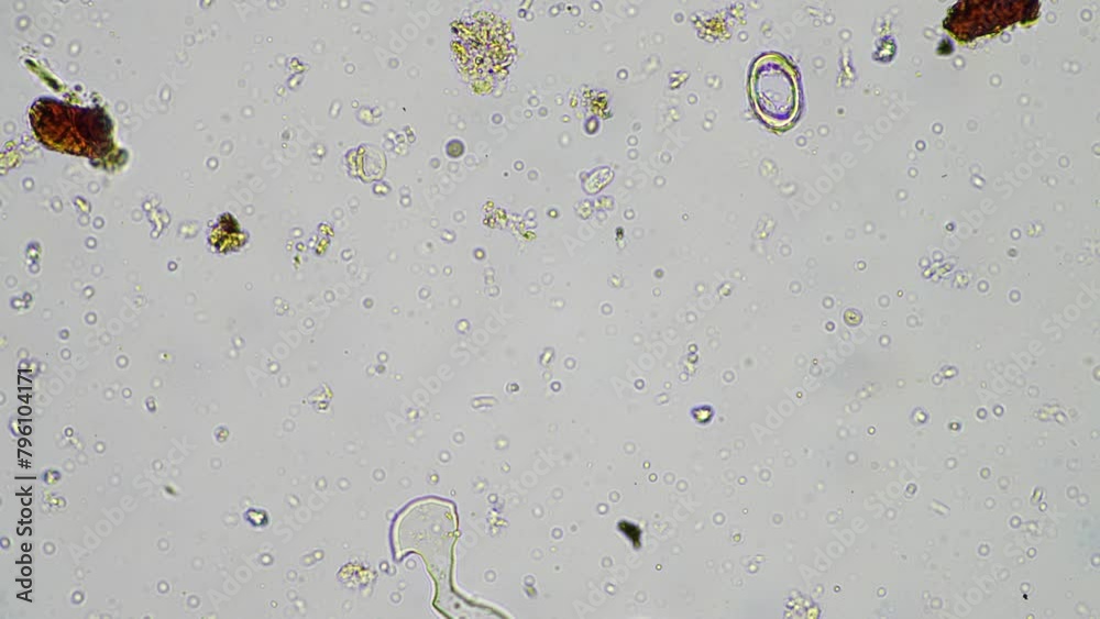 soil microorganisms in a soil life sample from a sustainable ...