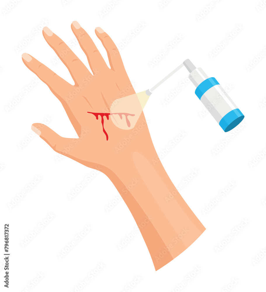 Hands injured skin and procedures of bandaging. First aid for wound ...