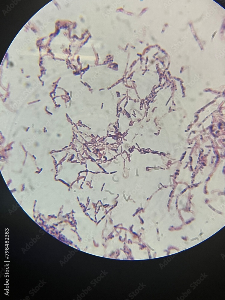 gram-positive bacillus bacteria seen at a microscope Stock Photo ...