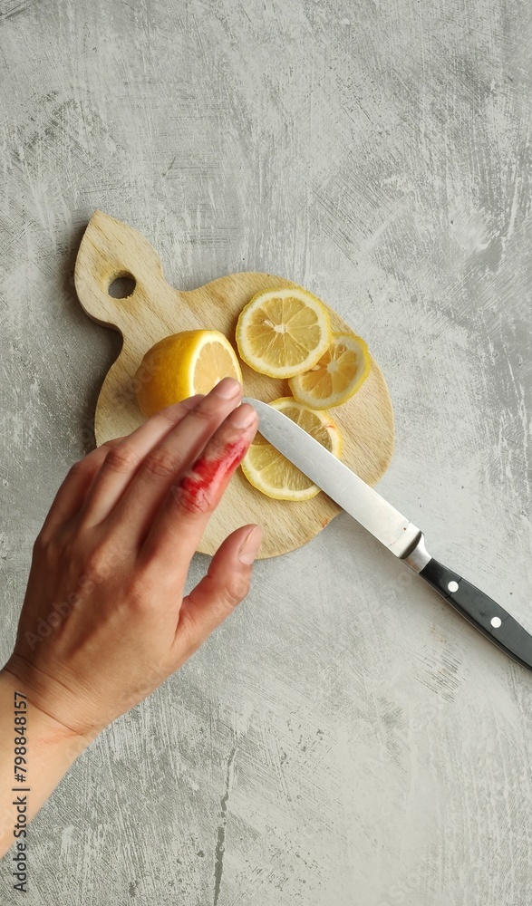 Close up hand injury, real bloody hand. Finger accidentally cut with ...