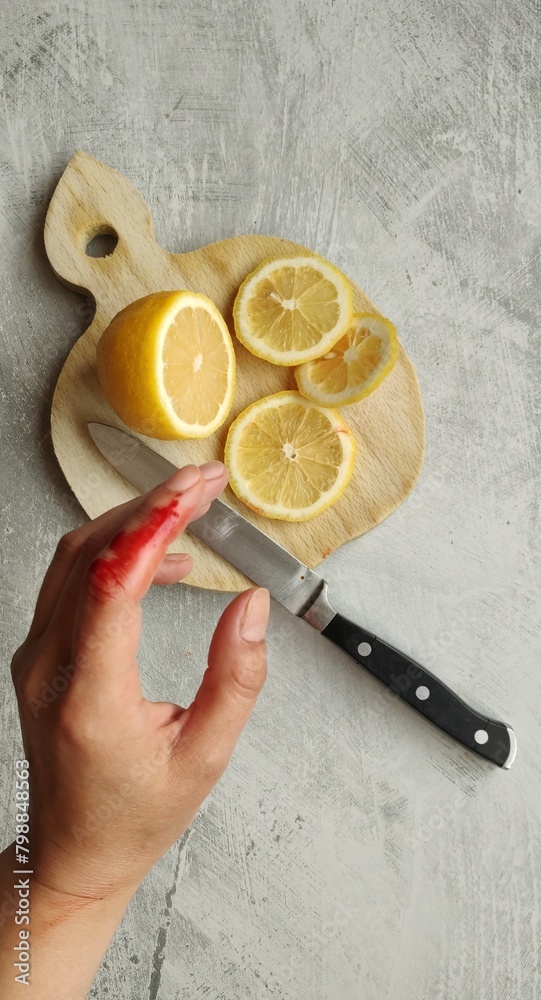 Close up hand injury, real bloody hand. Finger accidentally cut with ...