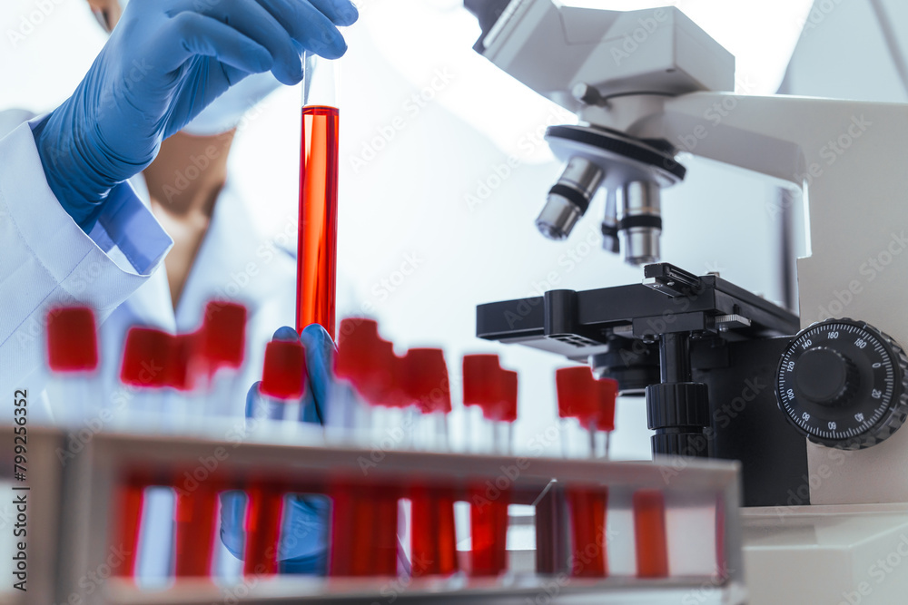 Hands of a doctor or female doctor collecting blood sample tubes from ...