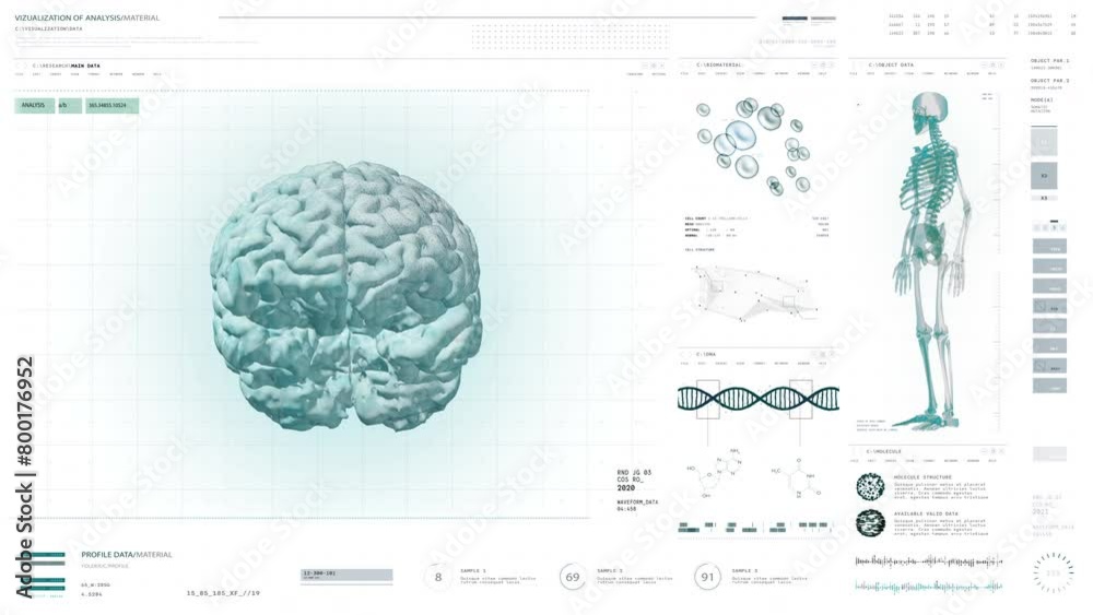 X-ray Diagnostic Of Human Brain By Futuristic Screening Interface ...