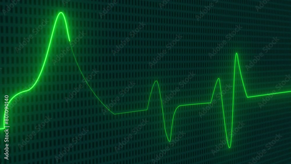 Heart rate monitor electrocardiogram background. Heart rate and pulse ...
