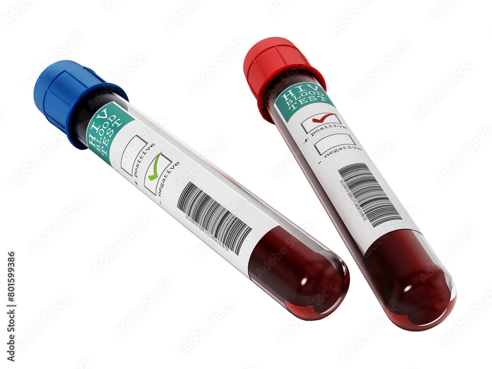 Positive and negative blood samples in vials with HIV test labels ...