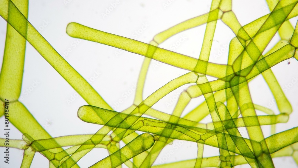 The water net (Hydrodictyon sp) under microscope. Collected from paddy ...