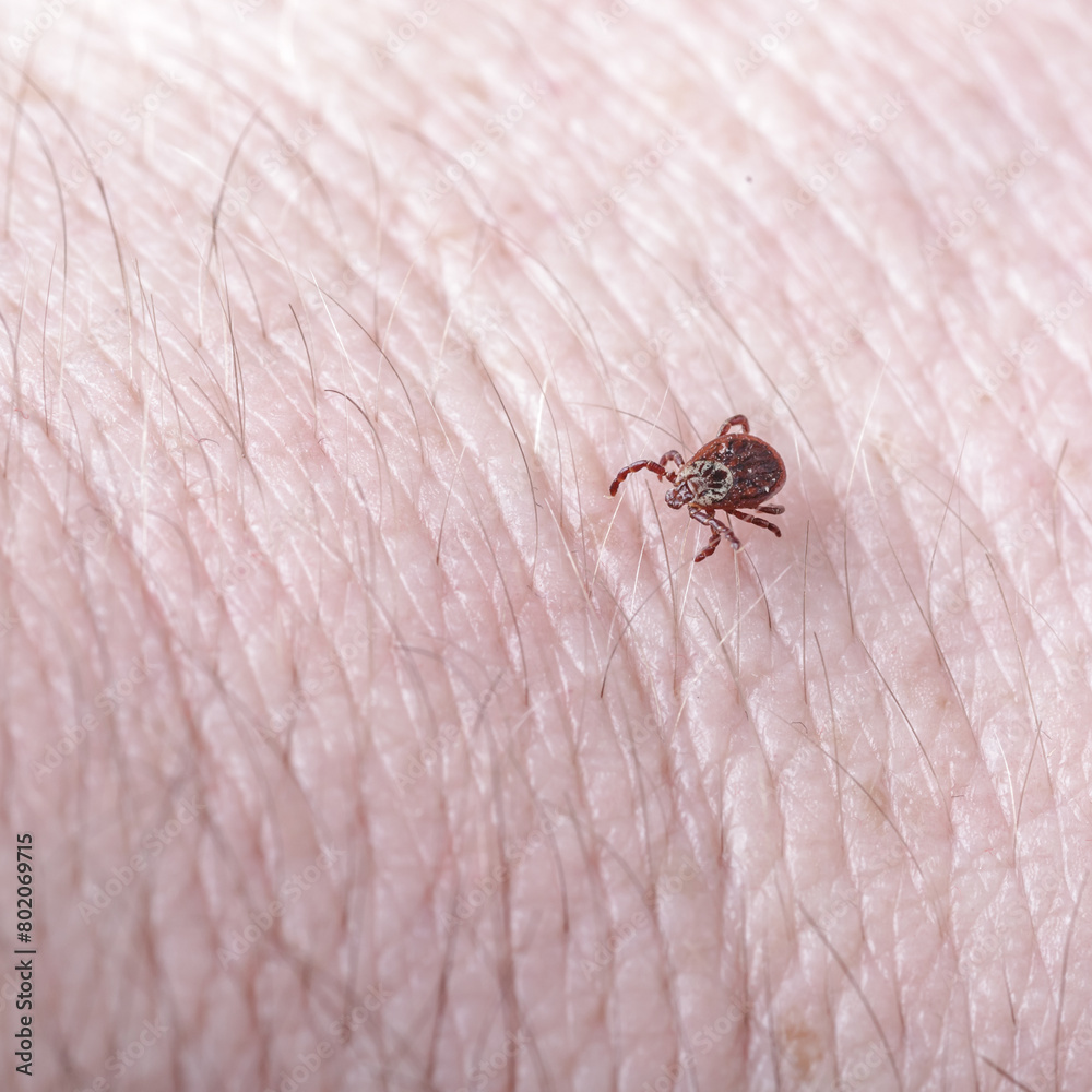 Adult female tick - Ixodes ricinus.A predatory parasitic tick crawls ...