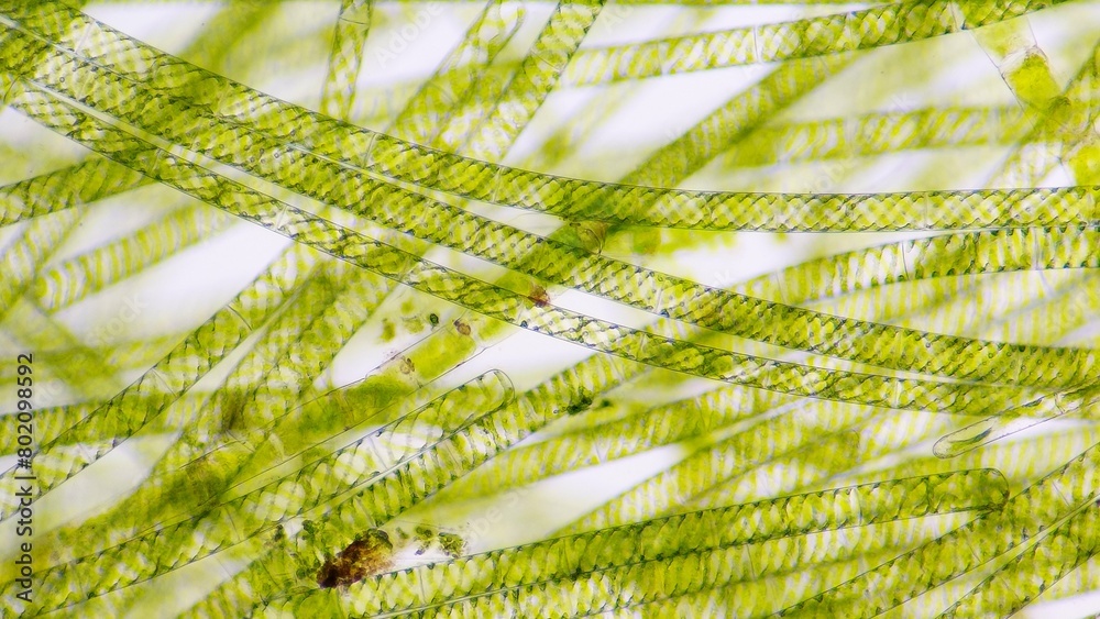 Spirogyra, a filamentous freshwater green algae with spiral arrangement ...