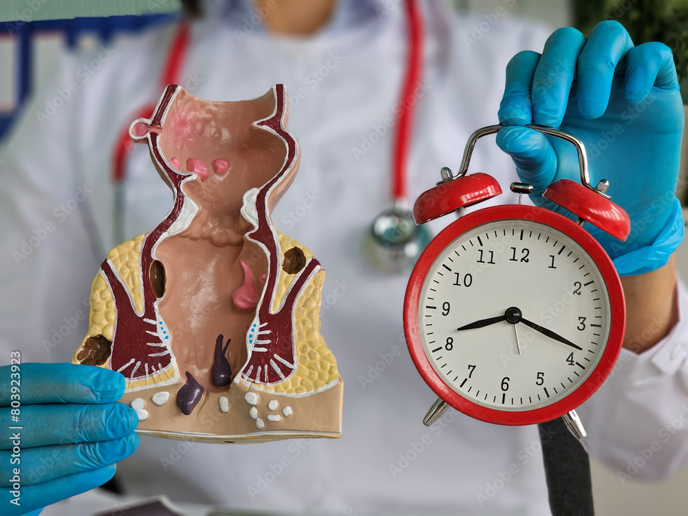 Doctor holding artificial rectum model and alarm clock. Timing and ...