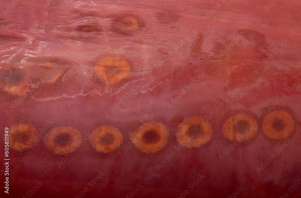 Circular spots on a real liver. Liver disease. Infested liver Stock ...