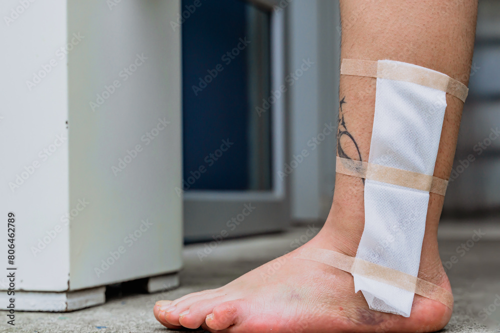 Woman at home with a broken and bandaged foot, leaning on a white chair ...