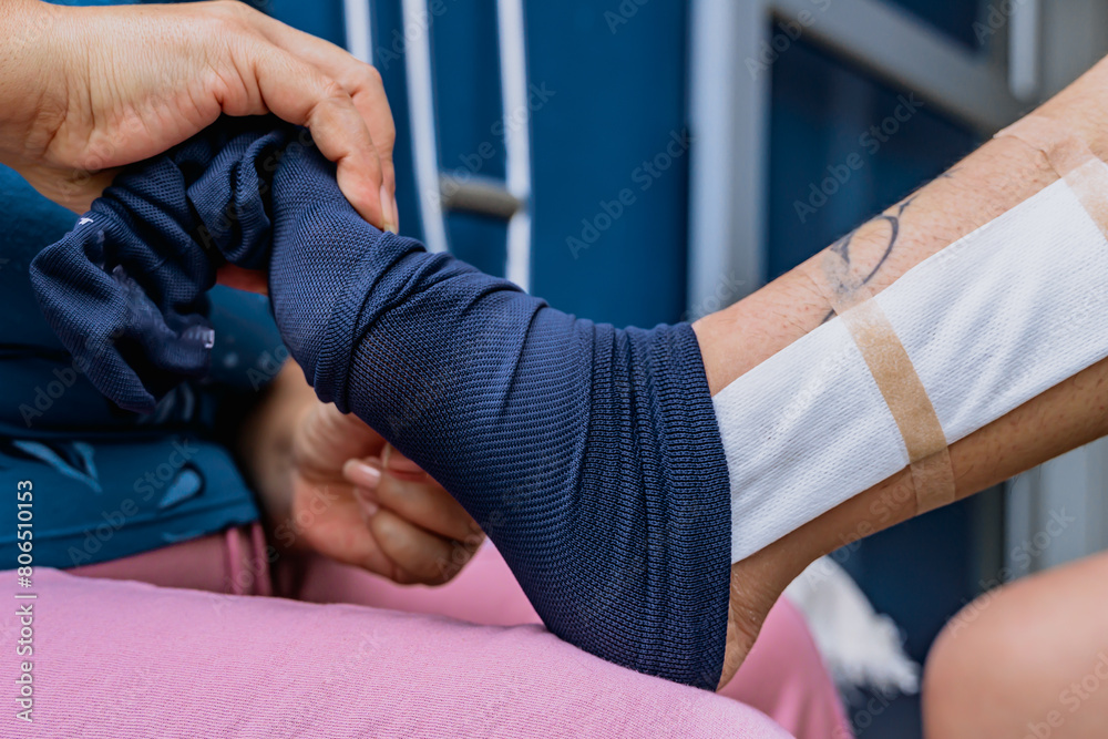 Domestic nurse putting compression stocking on woman with broken foot ...