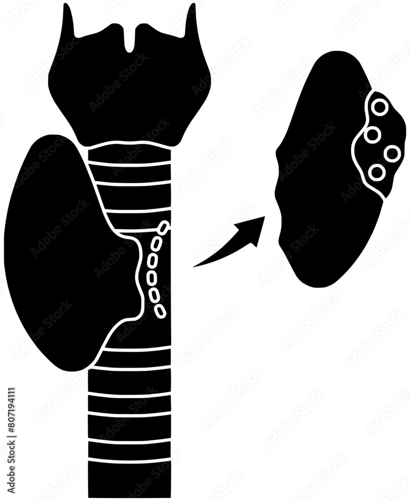Biology Illustration Anatomy Silhouette Thyroid Logo Structure Icon Organ Outline Anatomical
