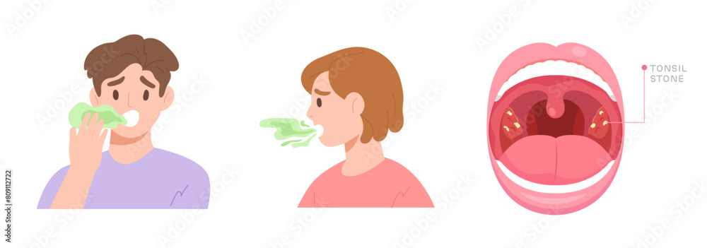 Illustration of and woman have bad breath problem and oral anatomy ...