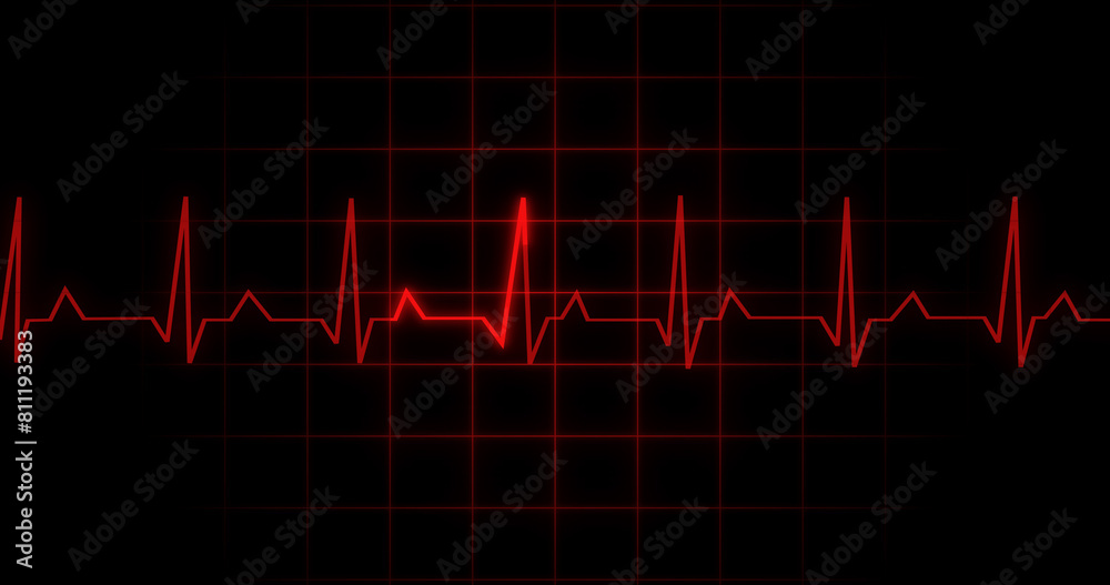 EKG Heartbeat reading animation on black background. Medical monitor ...