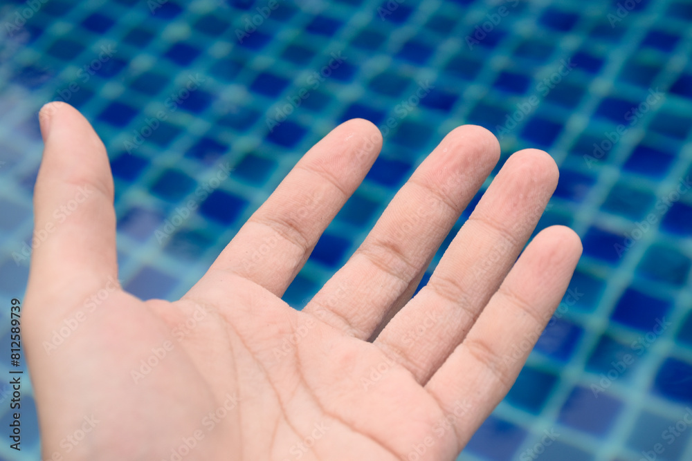 Symptom pruney and wrinkled skin hand and finger from water on blue ...