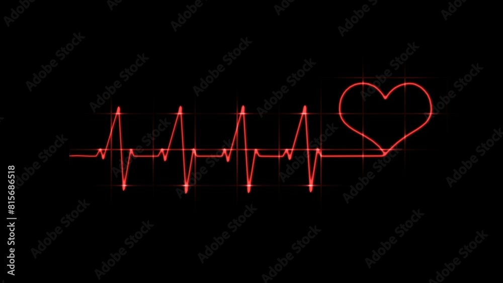 Electrocardiogram with transition to the heart. Red ECG scale on a ...
