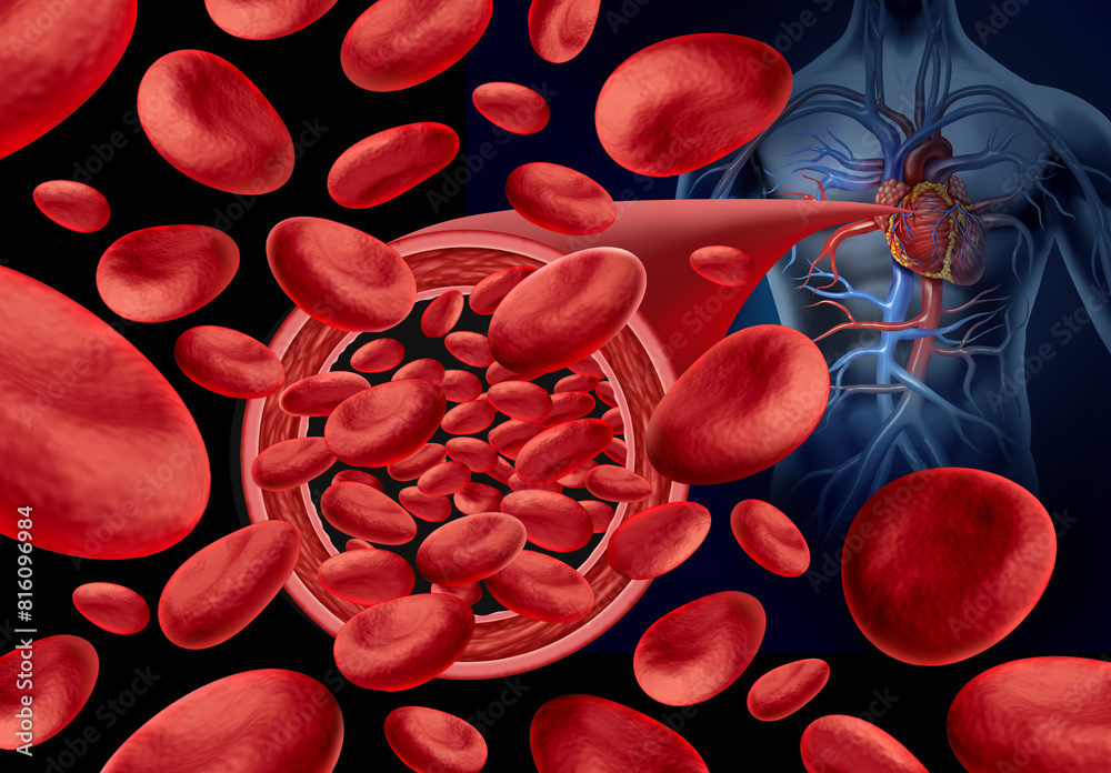 Normal Artery Blood Flow and healthy arteries with no Plaque as a ...
