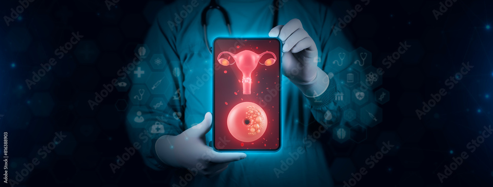 Photo & Art Print Cervical cancer concept, The doctor analyzes the ...