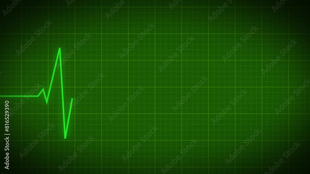 Heart beat cardiogram, heartbeat pulse line seamless loop animation ...