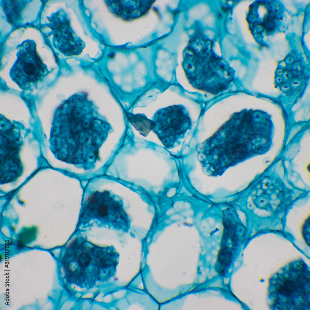 This is a photomicrograph of corn seeds.This photo focuses on the germ ...