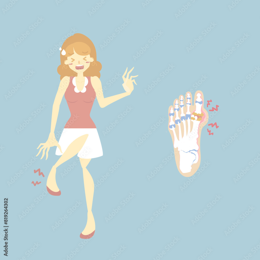 Woman having pain with big toe gout arthritis disease and foot bone ...