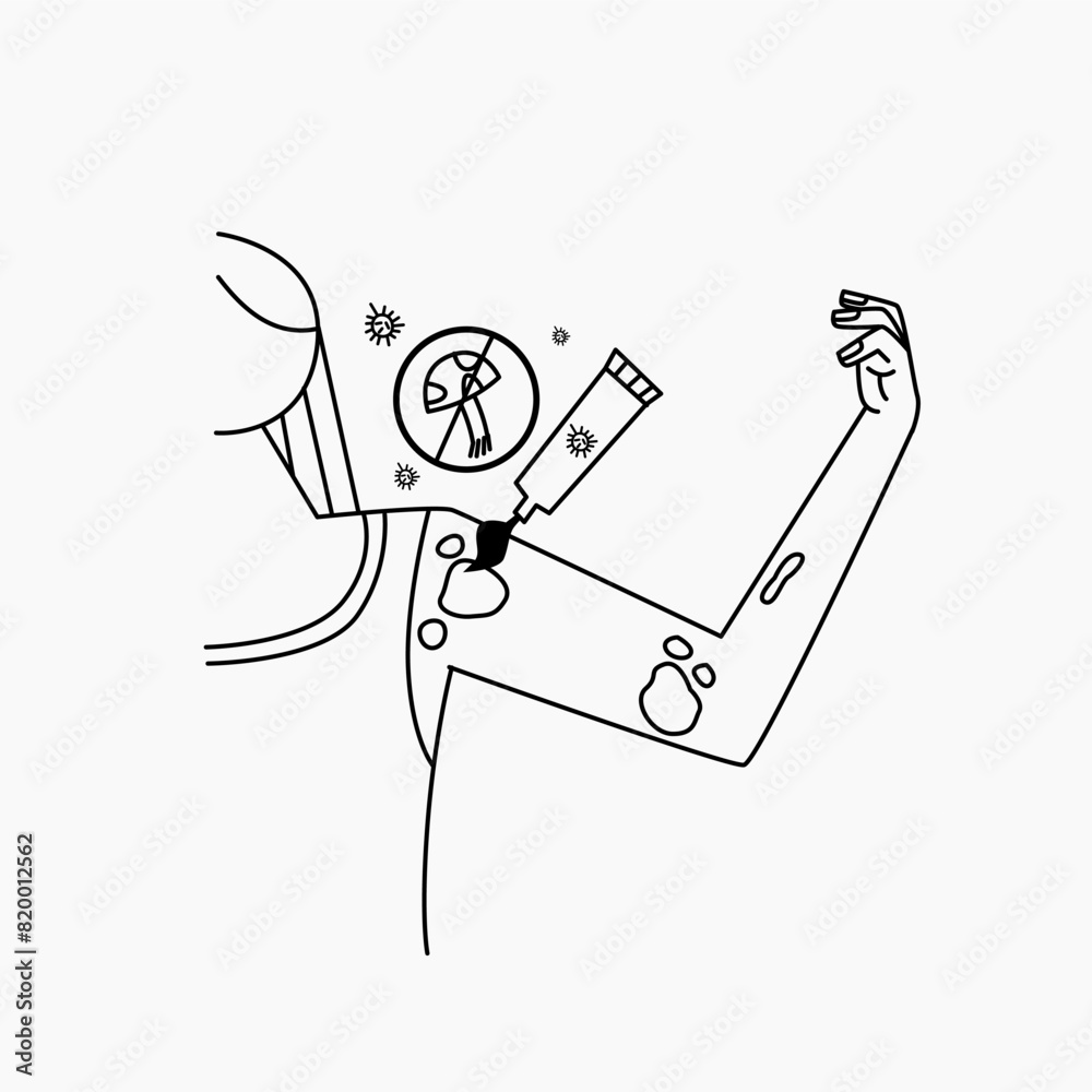 Black and white sketch of girl infected with tinea versicolor on body ...