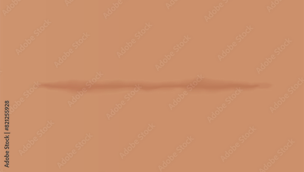 Healing wounds, skin scar, stitched gash and cut. Realistic surgical ...