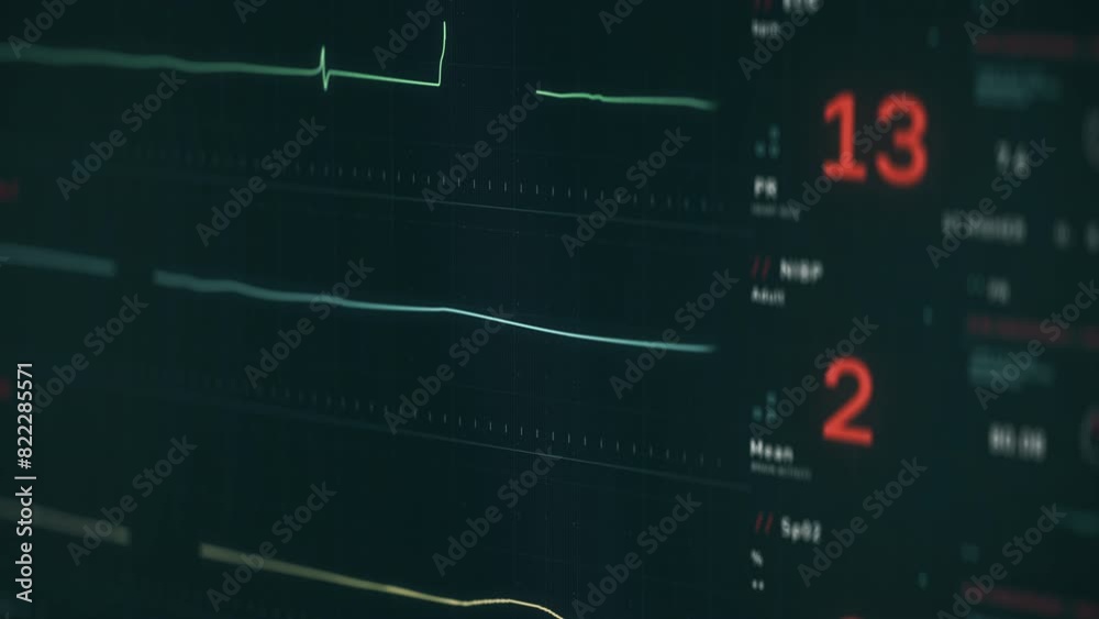Medical electronic device shows the pulse graph. Electronic pulse ...