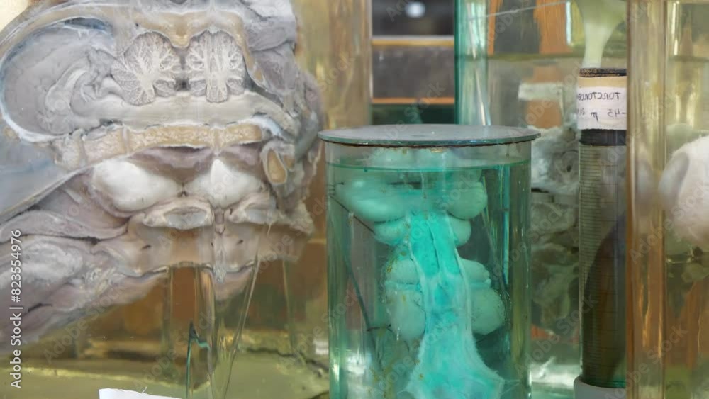Animals internals in glass jars with formaldehyde for medical research ...