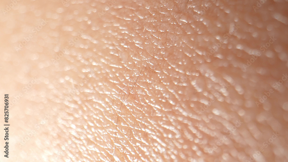 The arm's surface skin, seen in macro, showcases a complex network of ...