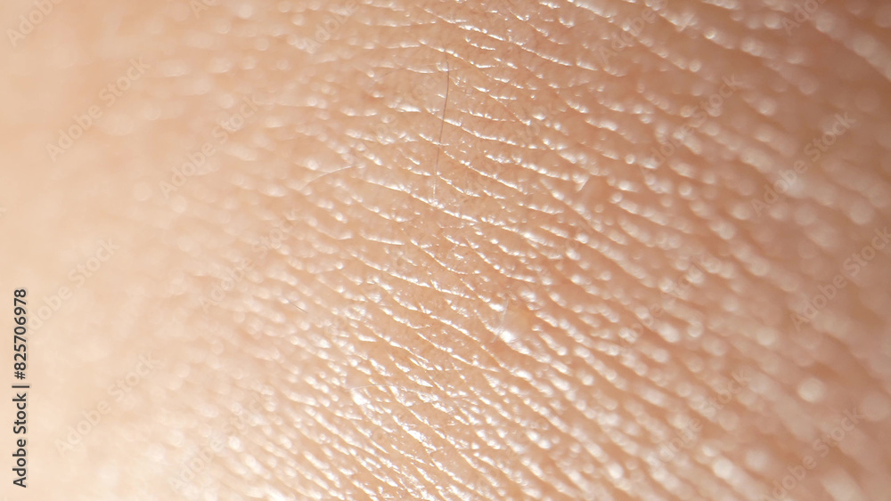 Explore the arm's skin surface in astonishing detail through macro ...