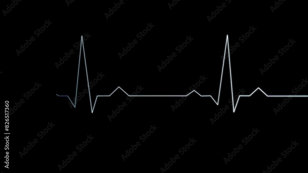 Heartbeat line illustration. Pulse line on display. Emergency ekg ...