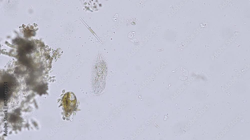 ciliates stylonychia (ciliated protozoan) from a river under the ...