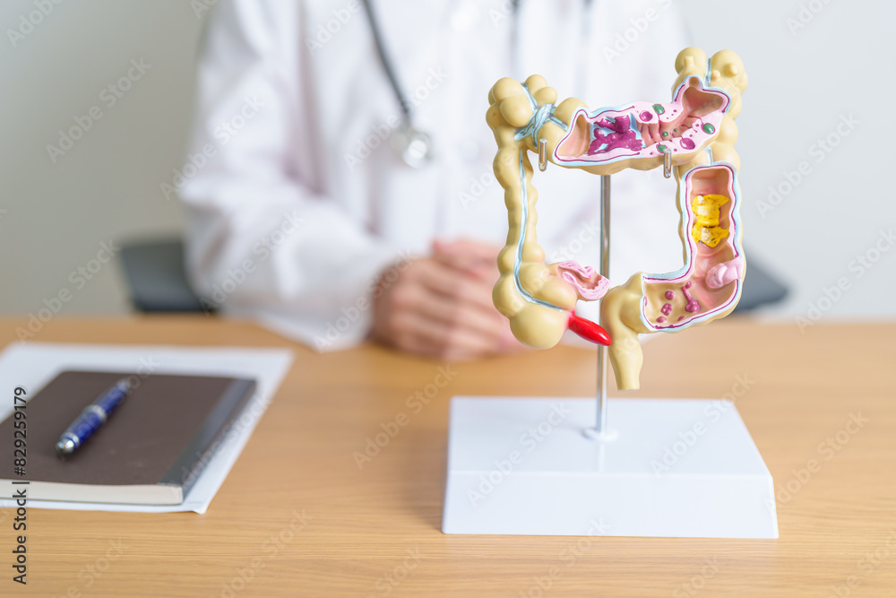 Doctor with human Colon anatomy model. Colonic disease, Large Intestine ...