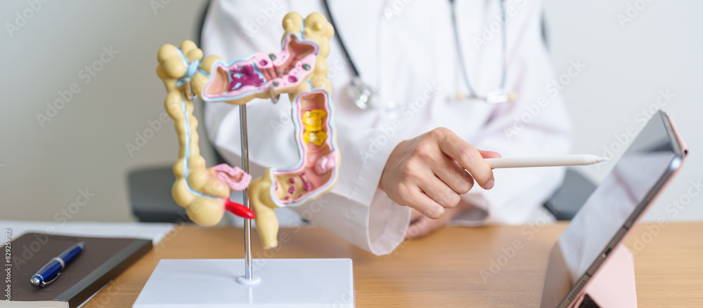 Doctor with human Colon anatomy model and tablet. Colonic disease ...