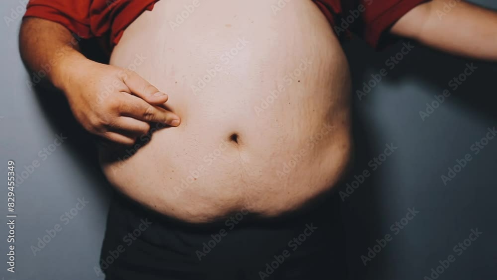 Man pointing own unhealthy big belly with visceral or subcutaneous fats ...
